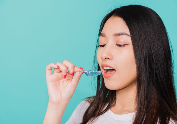 Retainer too tight or loose? What to do next – Caspersmile